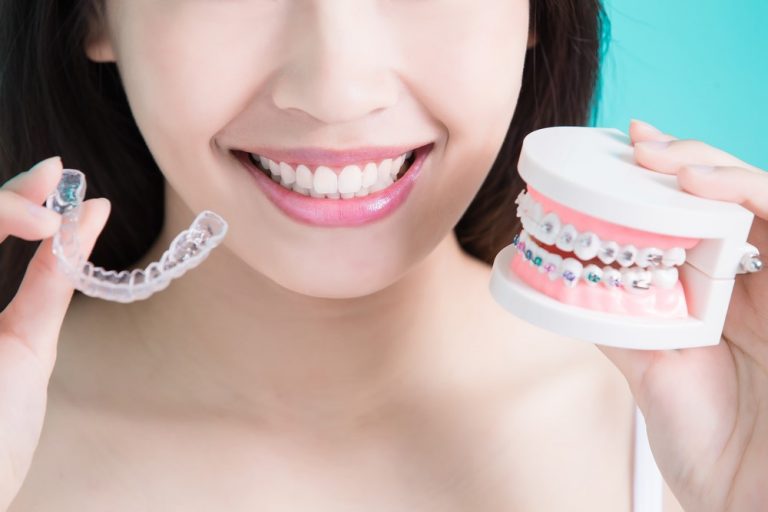 Braces For Your Teeth: Why They’re So Important In Some Cases - WorthvieW